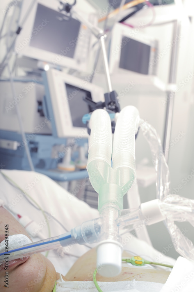 ICU patient Stock Photo | Adobe Stock