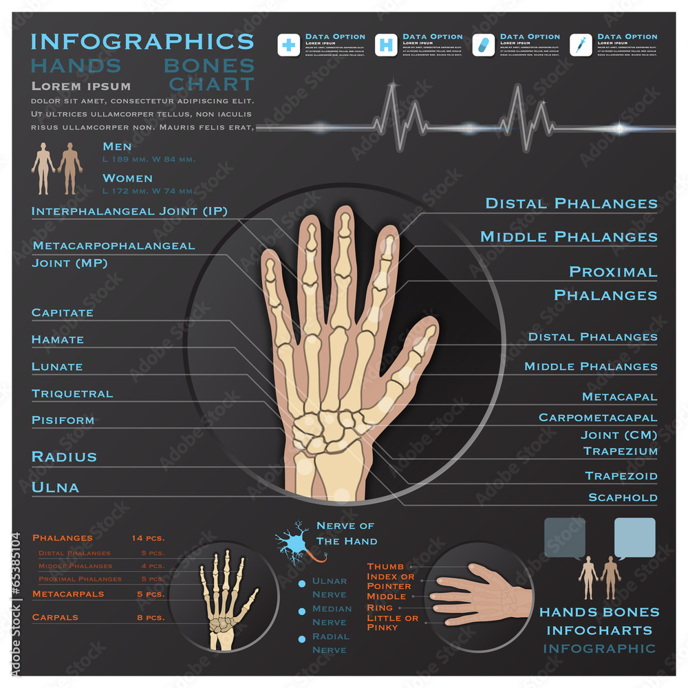 Hand Bone Skelatal System Infographic Infocharts Health And Medi Stock ...