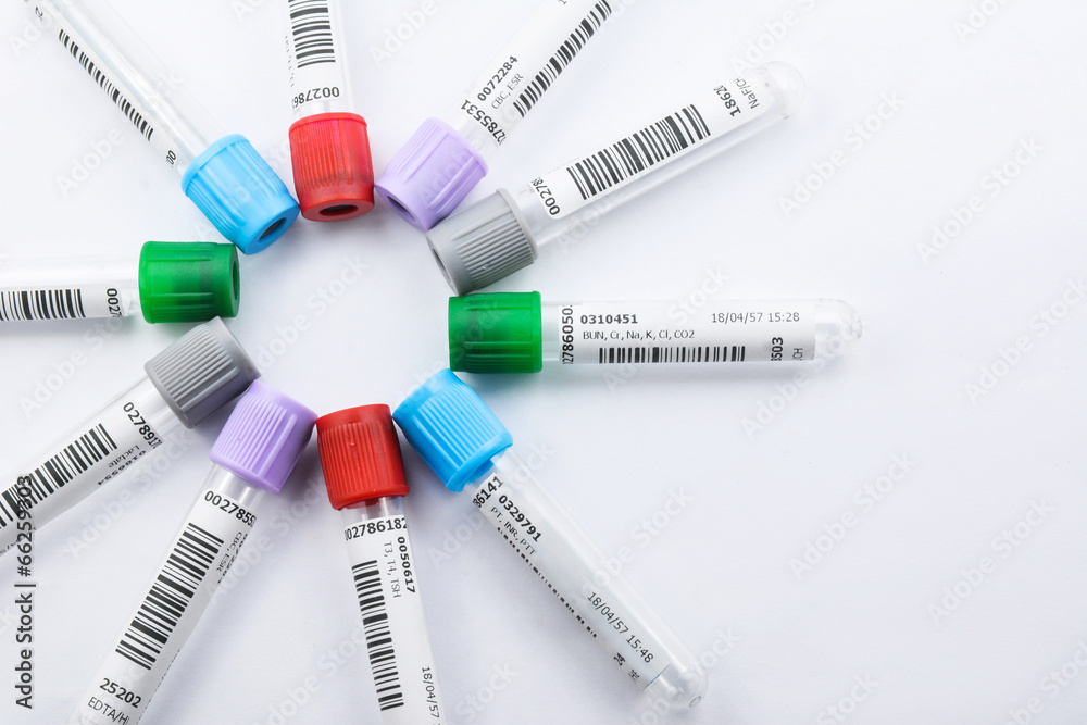 blood tube collection Stock Photo | Adobe Stock