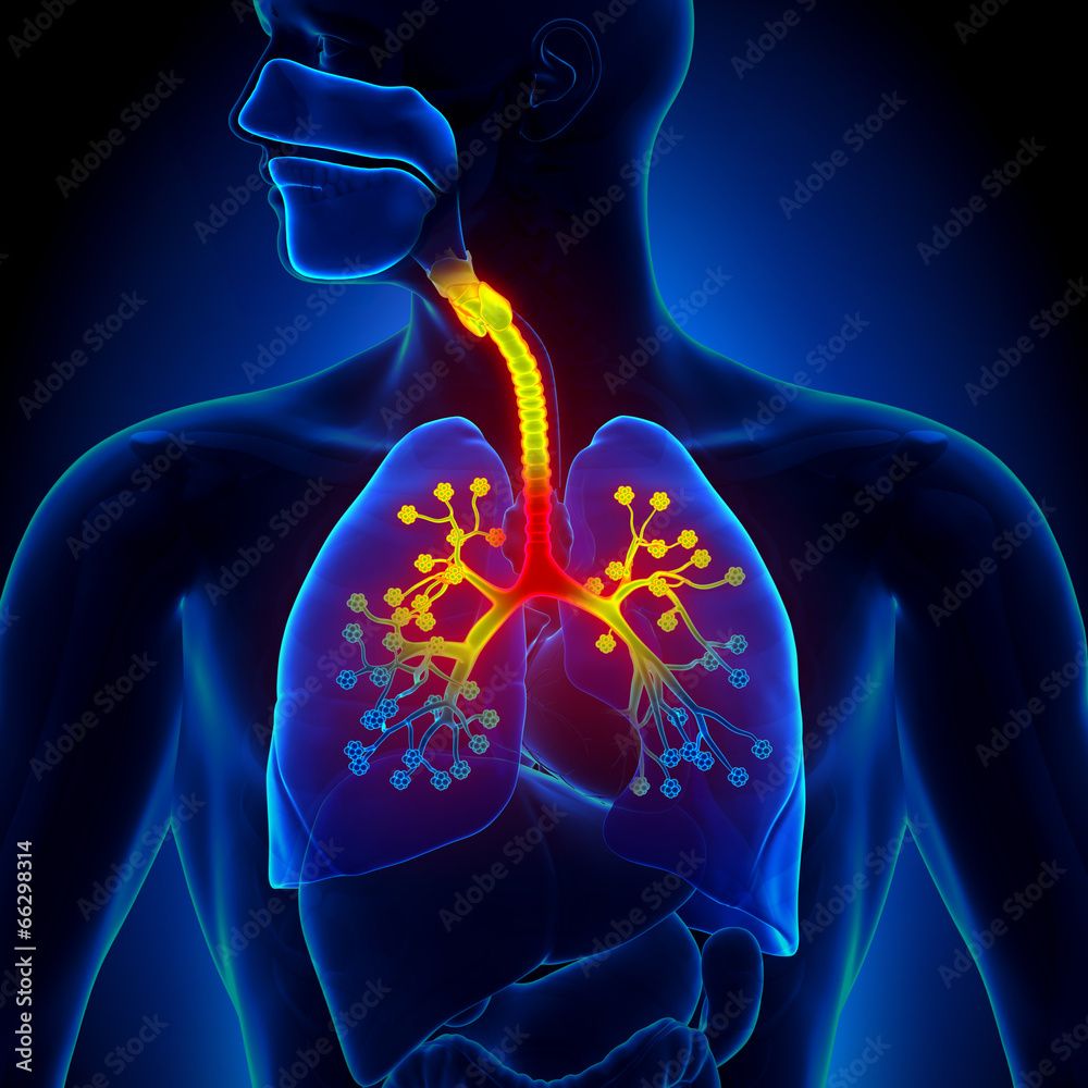 Bronchiolitis - Inflammation of the bronchioles Stock Illustration ...