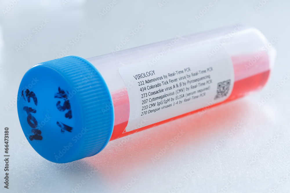 Molecular Diagnostic (PCR) Testing Stock Photo | Adobe Stock