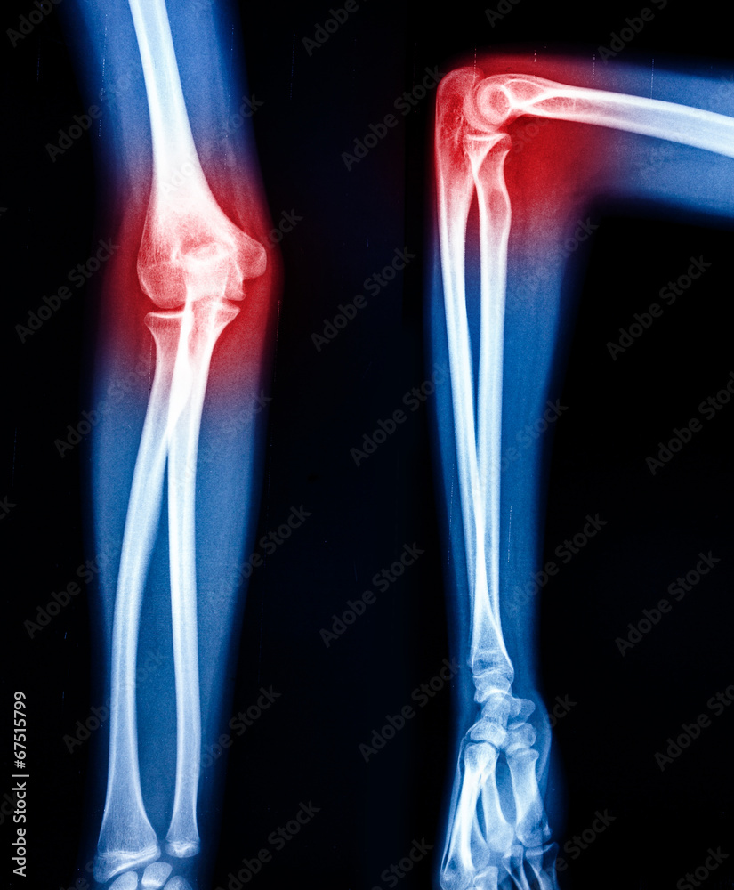 X-Ray scan human Stock Photo | Adobe Stock