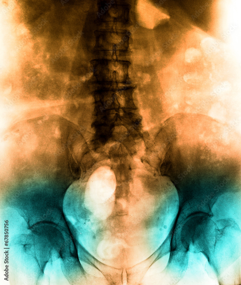 X-Ray scan human Stock Photo | Adobe Stock