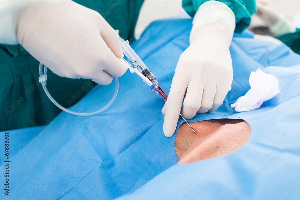 central venous pressure procedure Stock Photo | Adobe Stock