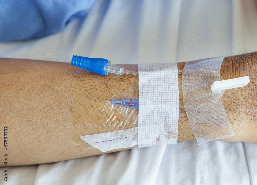 IV needle on patient arm for medicine injection Stock Photo | Adobe Stock