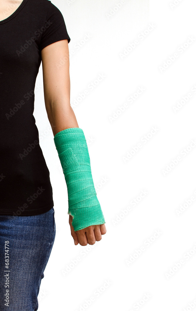 Green Arm Cast