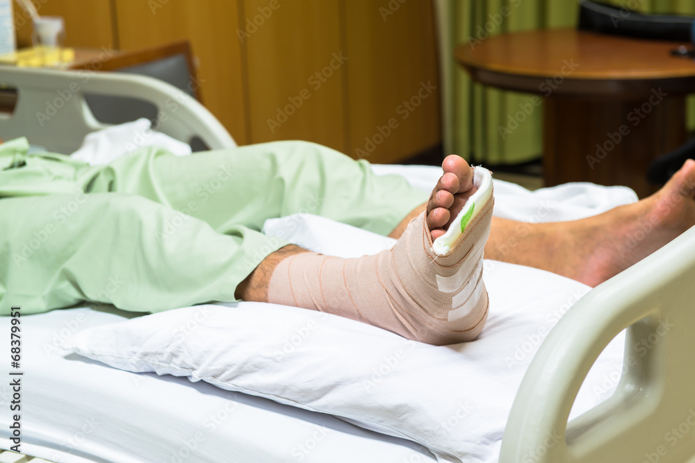 Patient with broken leg in cast and bandage Stock Photo | Adobe Stock