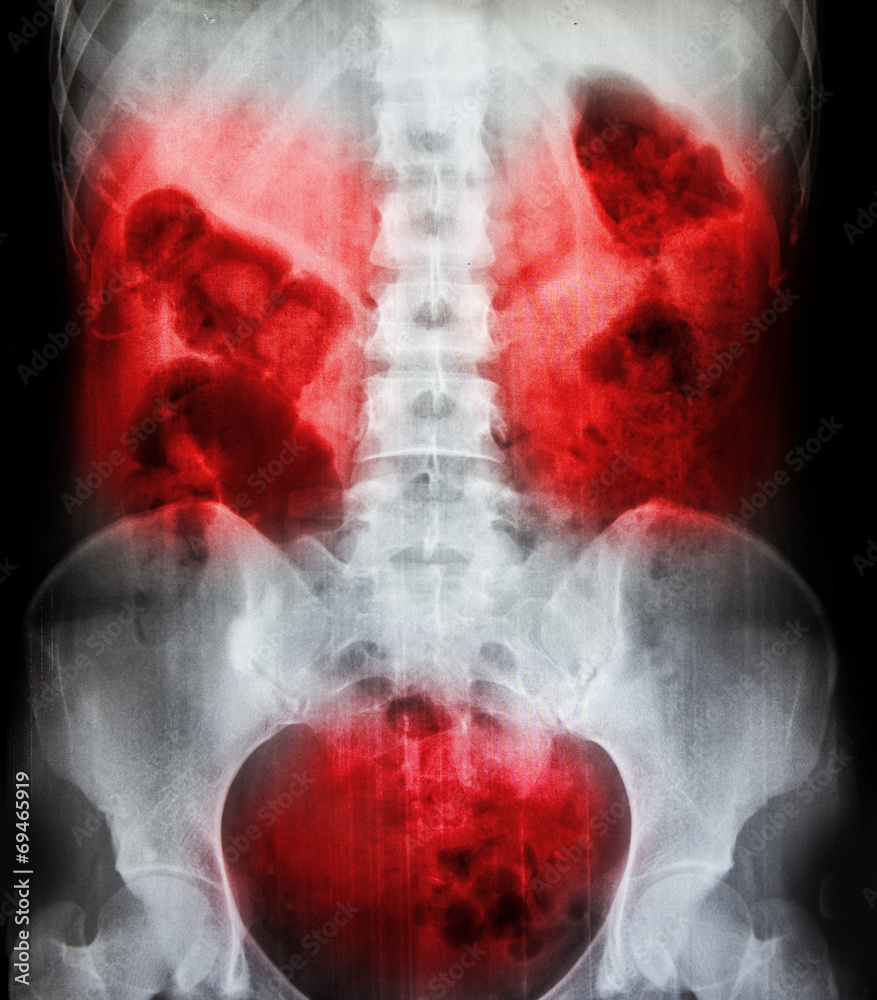 X-Ray scan human Stock Photo | Adobe Stock