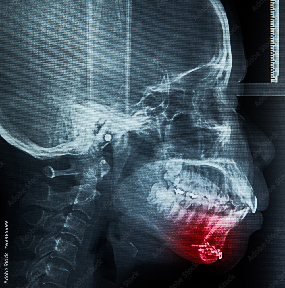 X-Ray scan human Stock Photo | Adobe Stock