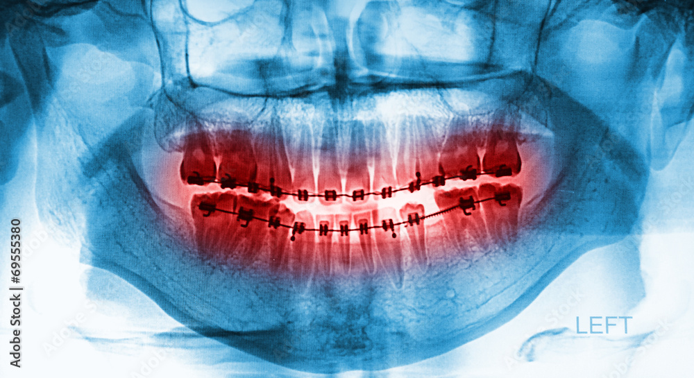 X-Ray scan human for teeth Stock Photo | Adobe Stock