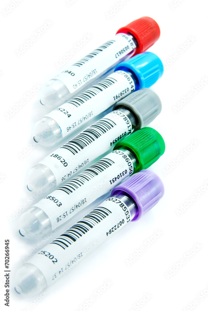 Medical test tubes with blood in laboratory Stock Photo | Adobe Stock