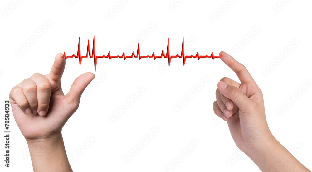hand drawing chart electrocadiogram (ECG) of ratio heartbeat on Stock ...