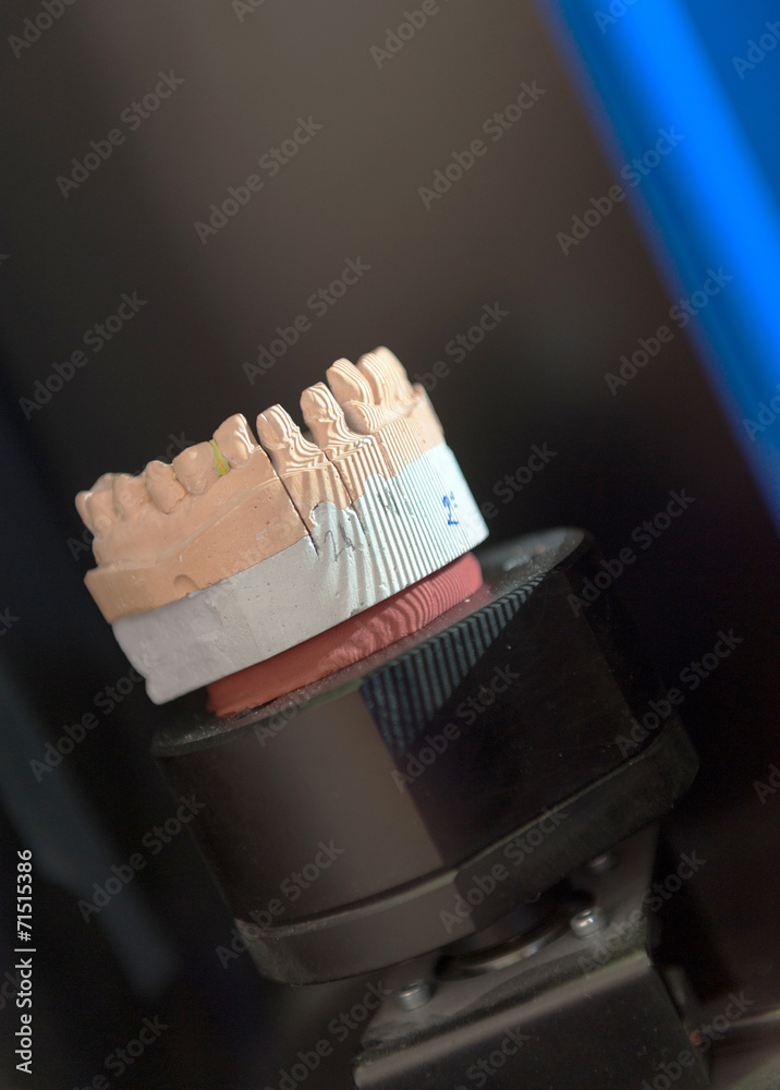 Dental prothetic Stock Photo | Adobe Stock