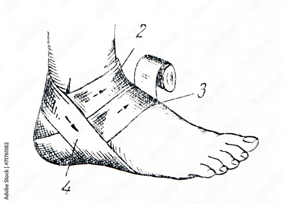 Triangular Bandage Techniques