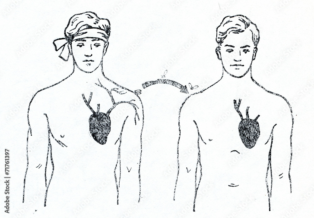 Disease transmission by biting insects Stock Photo | Adobe Stock