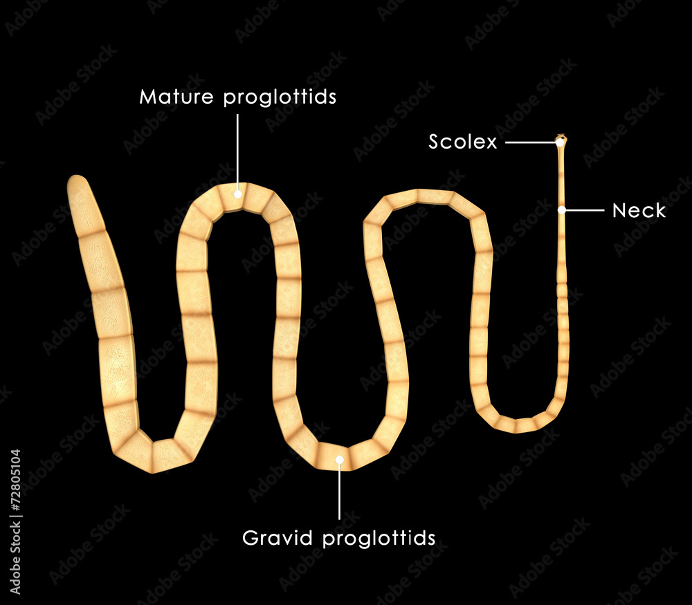 Taenia solium Stock Illustration | Adobe Stock