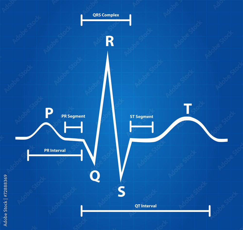 Blueprint Of Normal Electrocardiogram Graphic Stock Vector | Adobe Stock