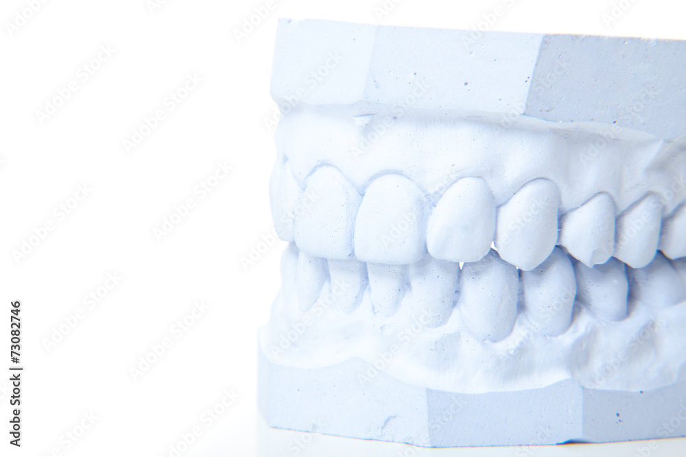 Plaster cast of perfect teeth. All on white background. Stock Photo ...