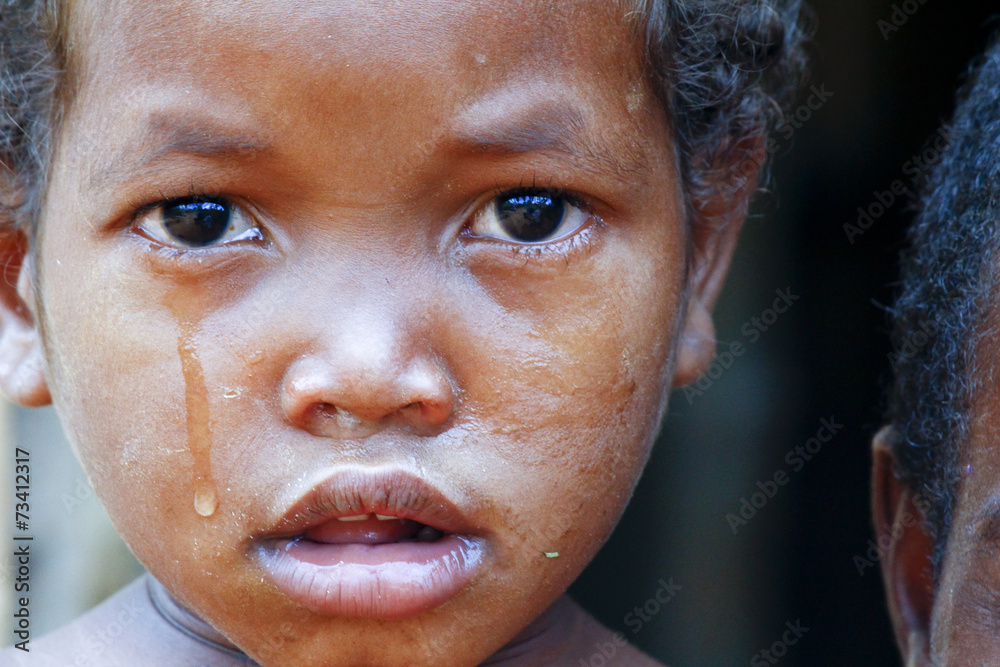 Crying girl with tear on cheek - poor african child Stock-Foto | Adobe ...