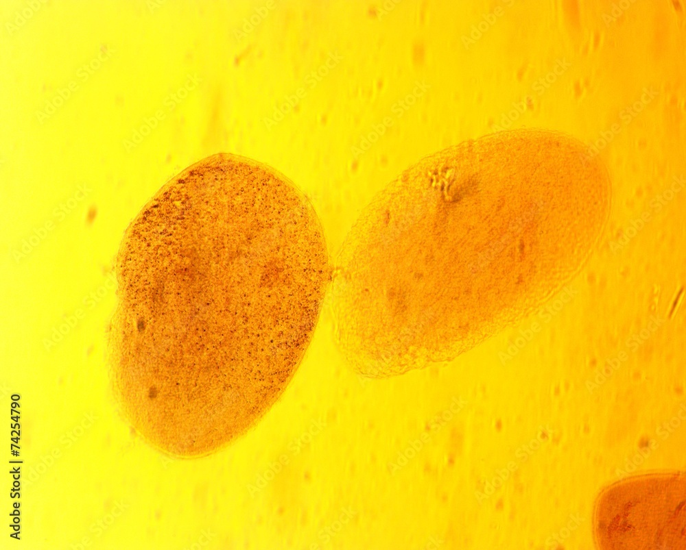 Opalina ranarum - permanent slide plate under high magnification Stock ...