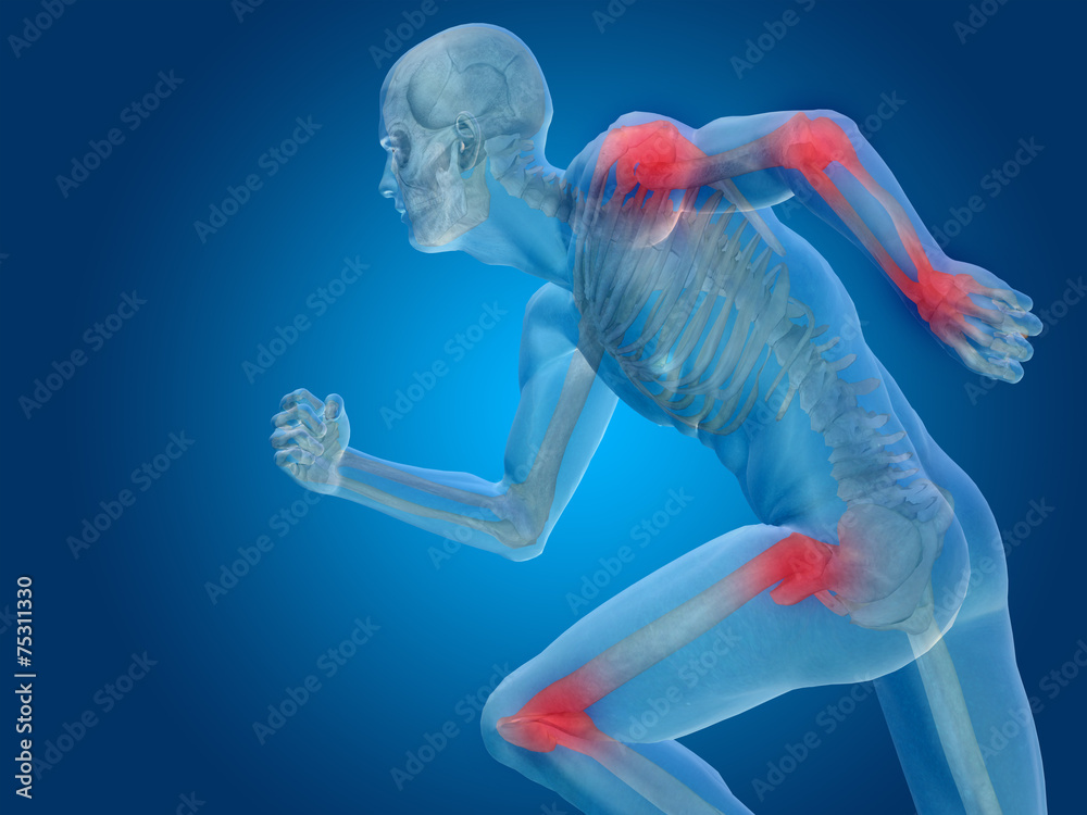 Conceptual human body anatomy pain on blue Stock Illustration | Adobe Stock