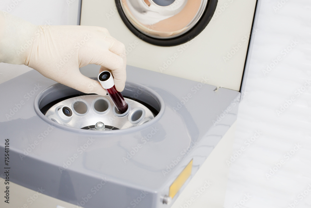 Preparation of blood for injections Plasmolifting Stock Photo | Adobe Stock