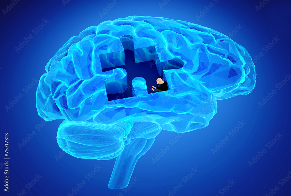 Dementia disease and a loss of brain function and memories ilustração ...