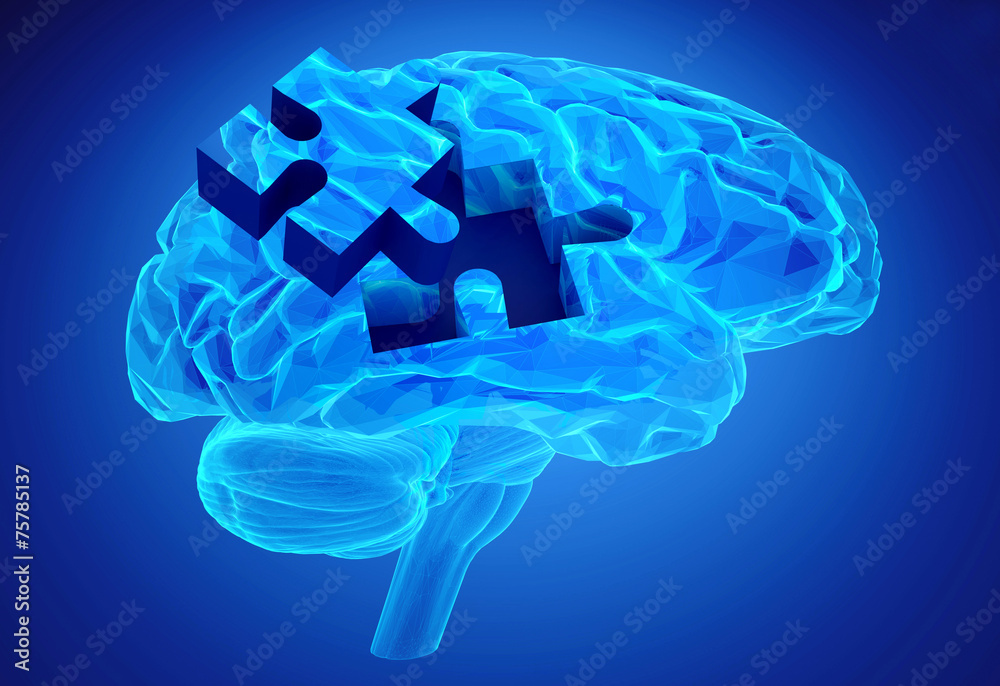 Dementia disease and a loss of brain function and memories Stock ...