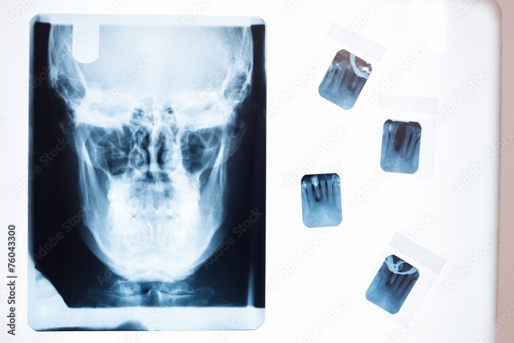 Overhead of a x-ray of a human skull Stock Photo | Adobe Stock