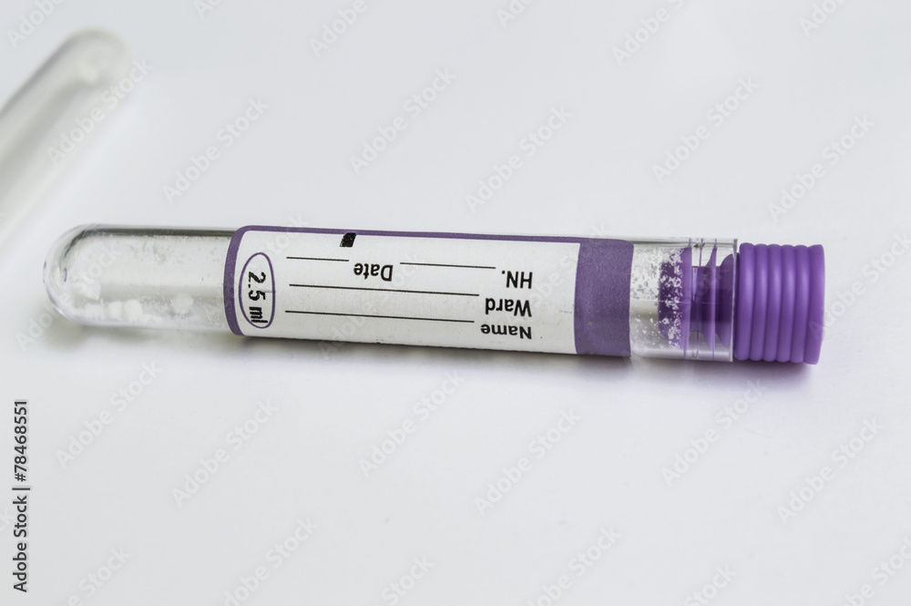 vacutainer,test tube Stock Photo | Adobe Stock