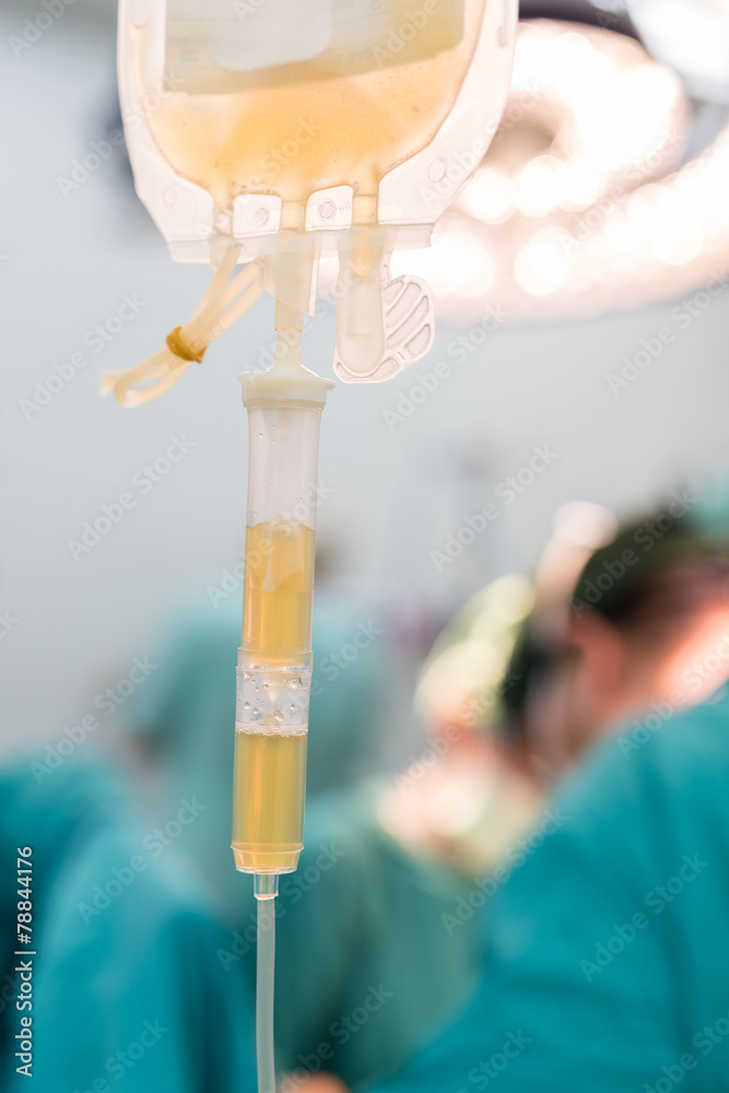giving fresh frozen plasma blood components during surgery Stock Photo ...