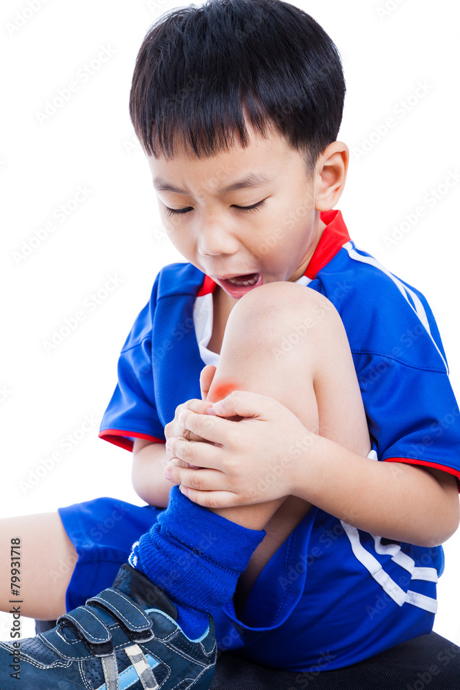Child shin with a bruise and painful Stock Photo | Adobe Stock