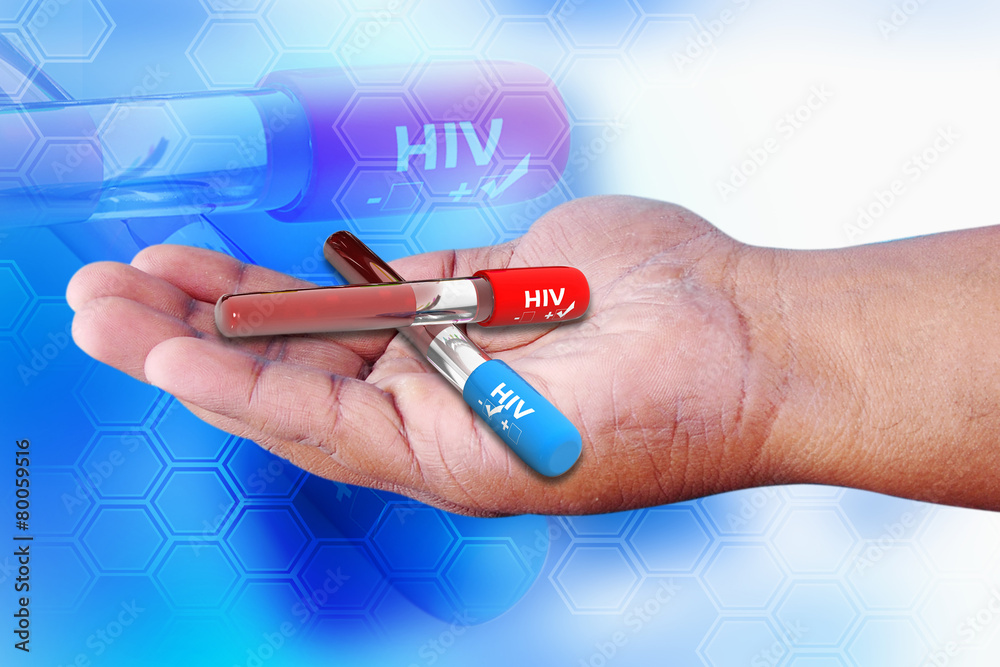 Blood collection tube with HIV test , HIV positive and negative Stock ...