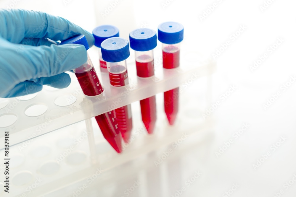 Blood. Blood samples in a rack foto de Stock | Adobe Stock