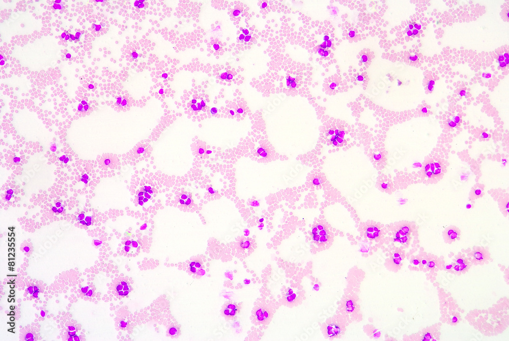 A blood smear is often used as a follow-up test to abnormal resu Stock ...