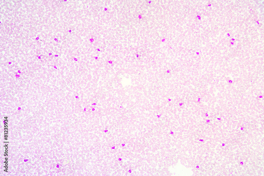 A blood smear is often used as a follow-up test to abnormal resu Stock ...