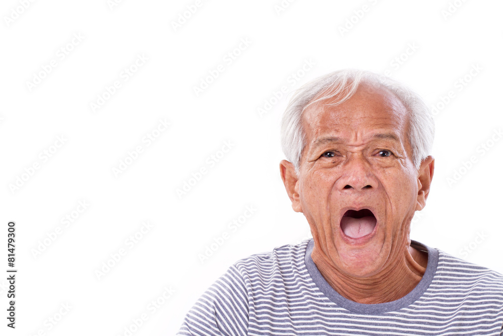 shocked, stunned, unhappy old man with surfer’s eye or pterygi Stock ...