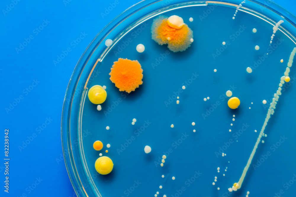 Yellow and orange Bacterial colonies on agar agar substrate in p Stock ...