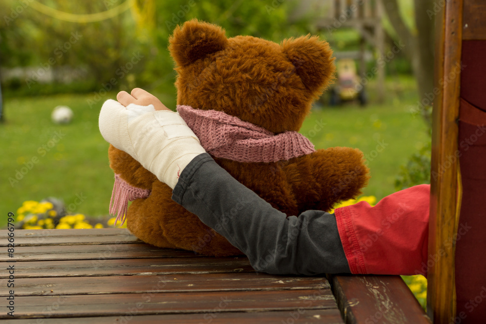 Gipsarm Stock-Foto | Adobe Stock