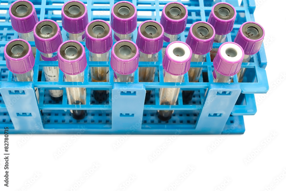 Blood sample test tubes in rack on white background, laboratory working ...
