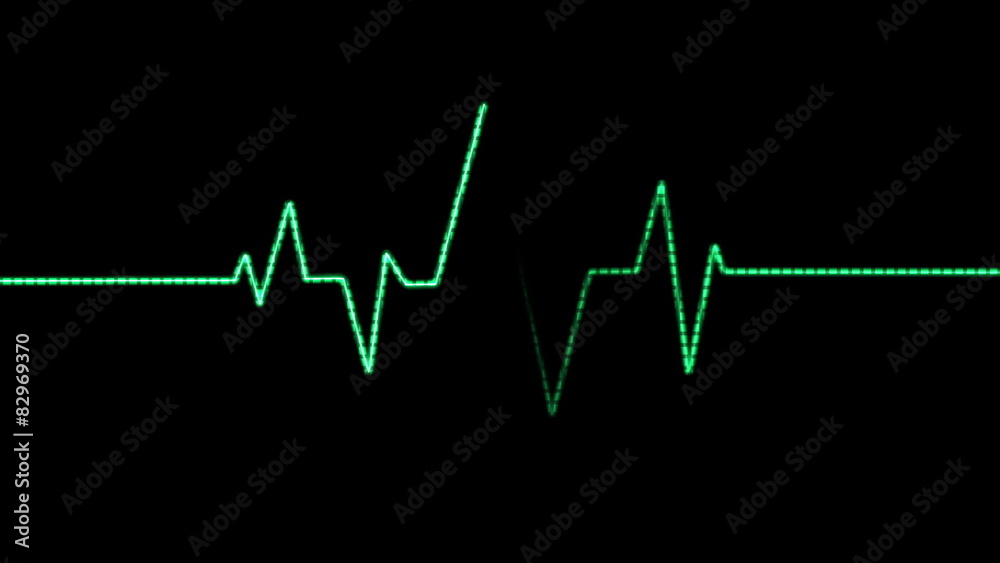 Heart Rate Monitor (30fps). A loopable animation blip of a heart beat ...