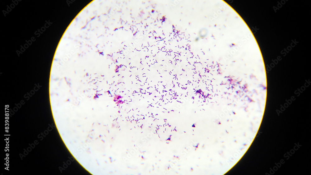 bacteria Gram staining under microscope Stock Photo | Adobe Stock