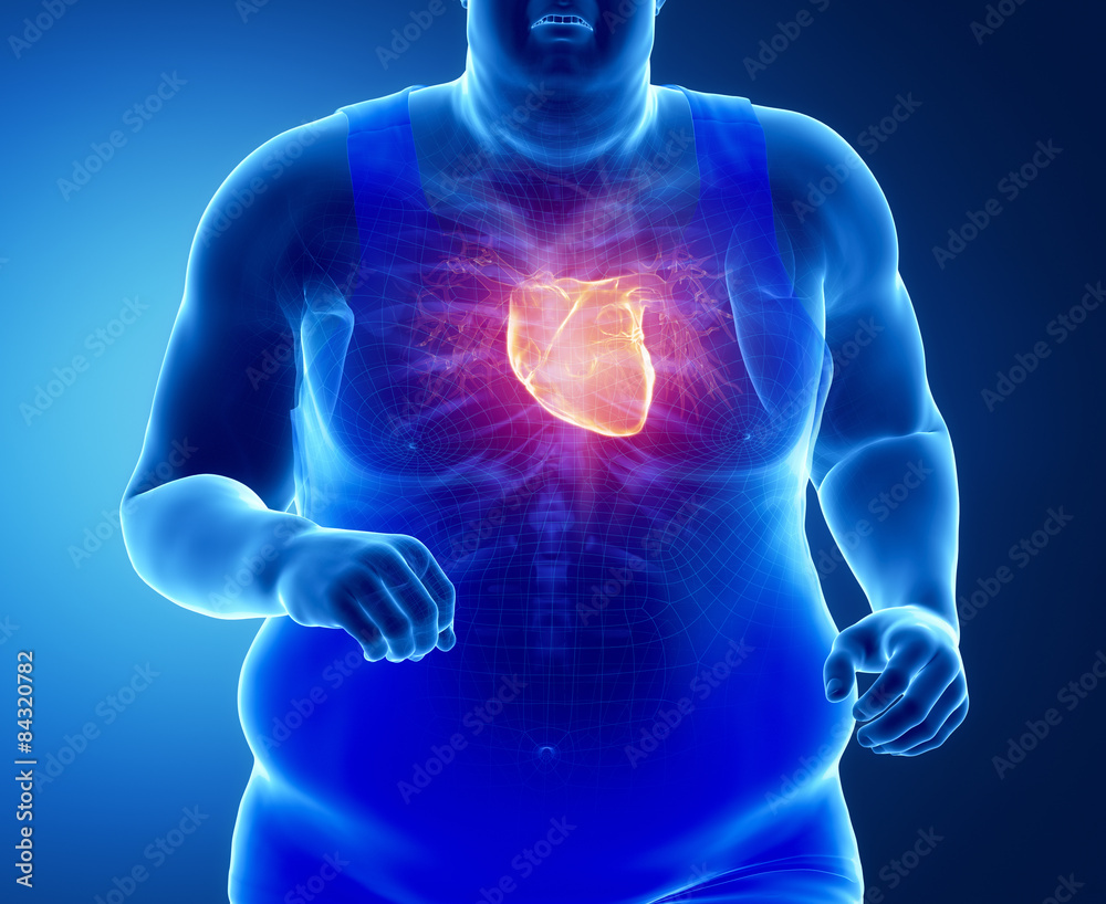 Fat obese man running with heart attack concept Stock Illustration ...