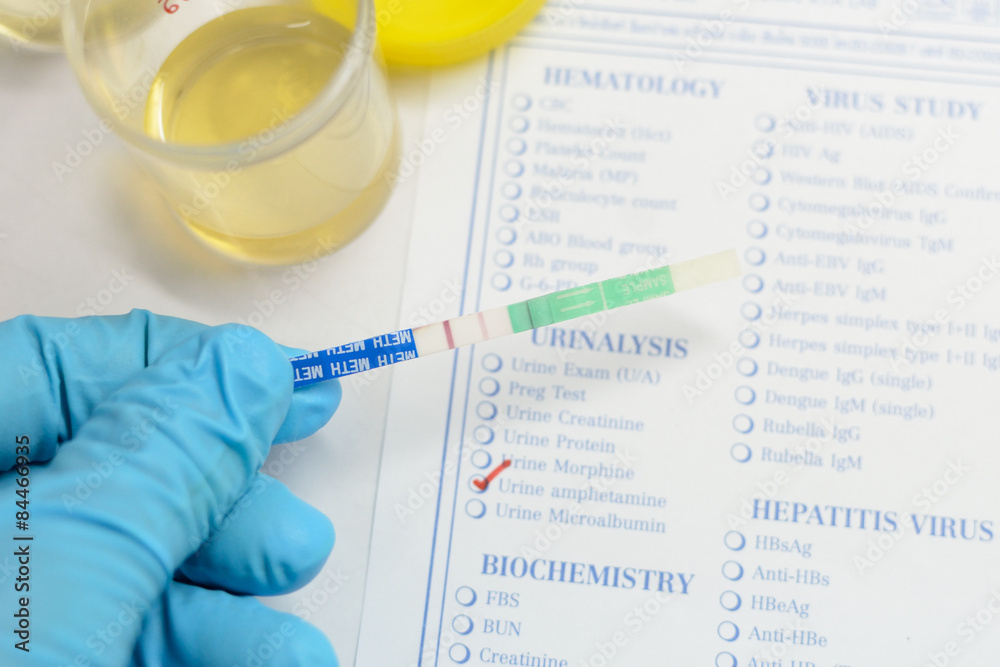 Urine analysis Stock Photo | Adobe Stock