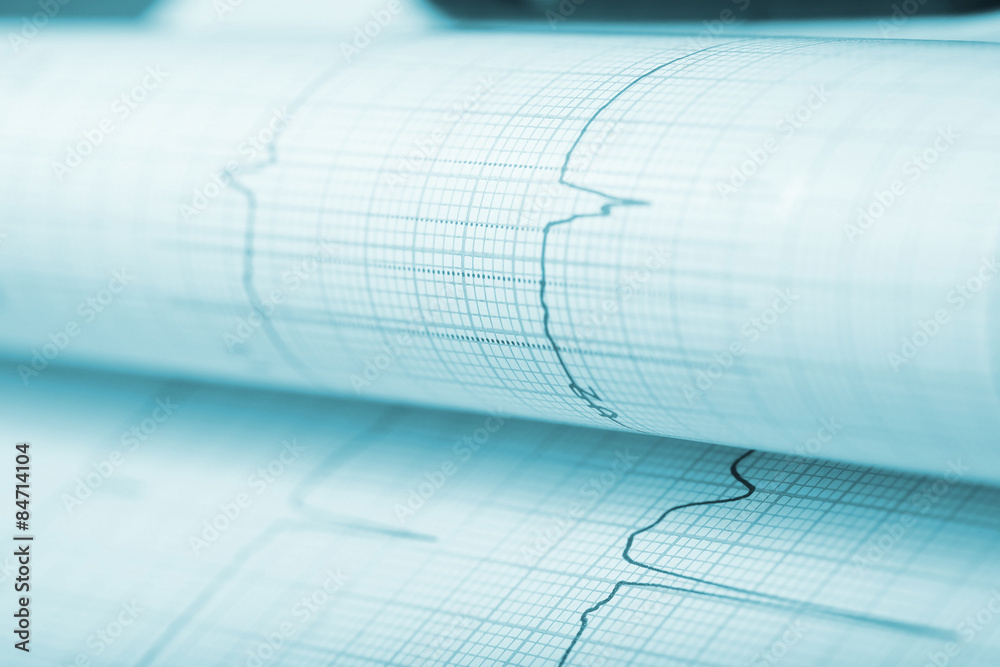 ECG chart as medical background Stock Photo | Adobe Stock