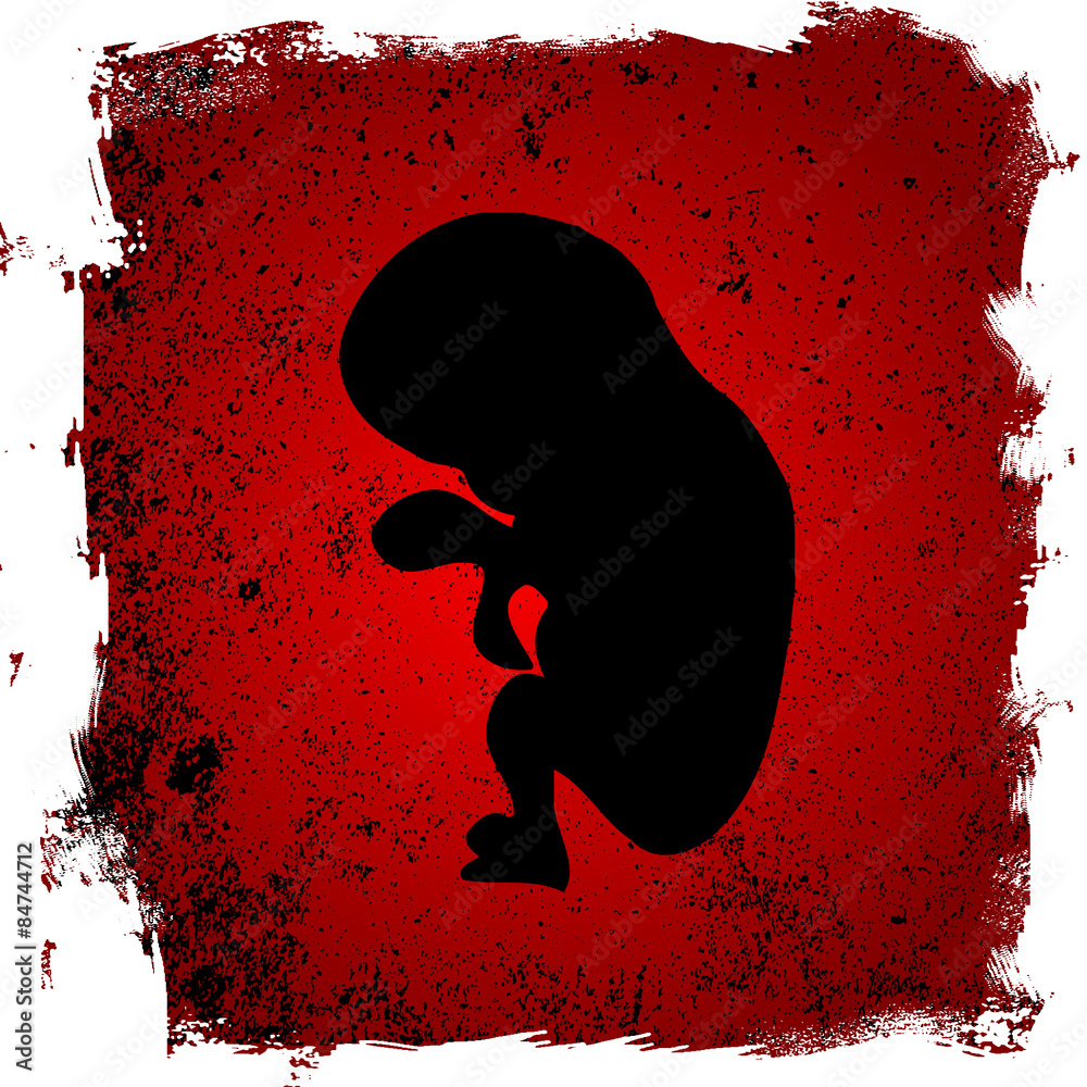 Abortion Stock Vector | Adobe Stock