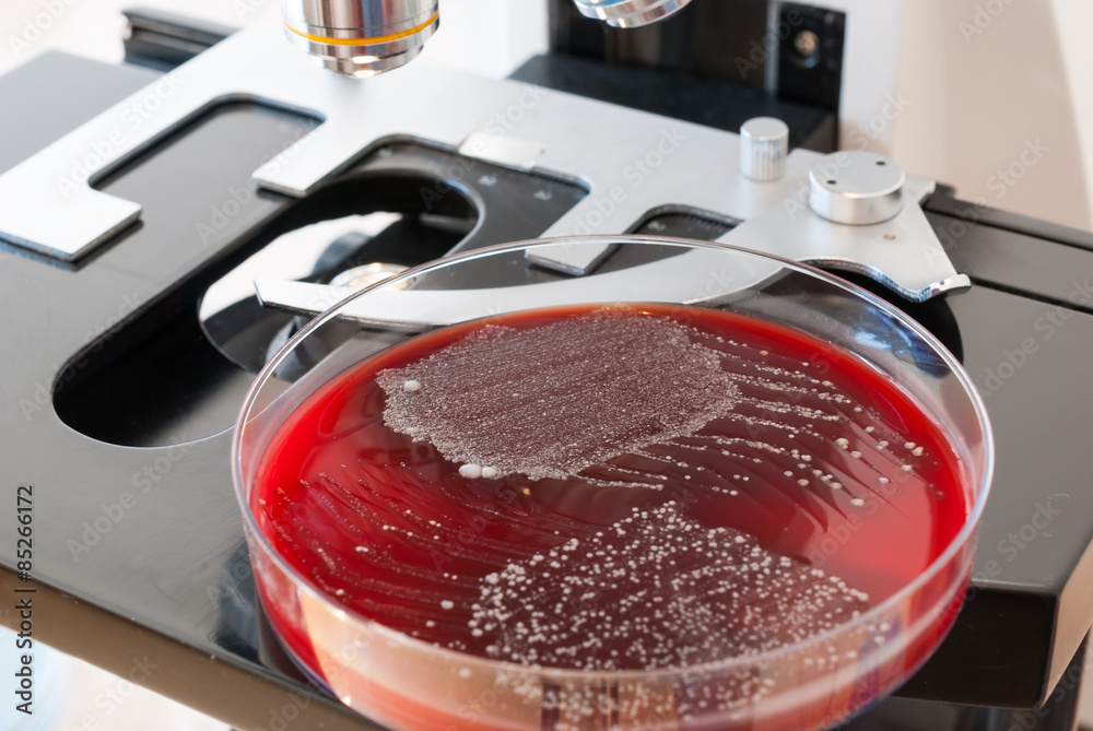 Staphylococcus aureus bacteria from nasal exudate on petri dish and ...