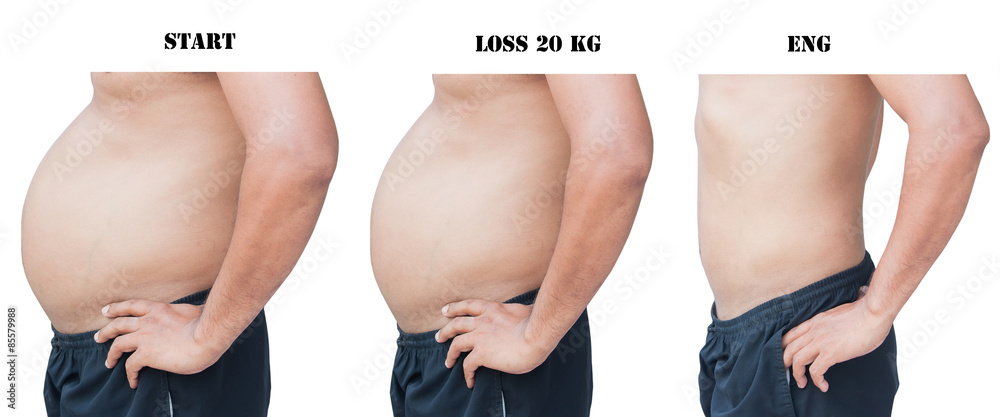 body man before and after fat loss 20 kilogram Stock Photo | Adobe Stock