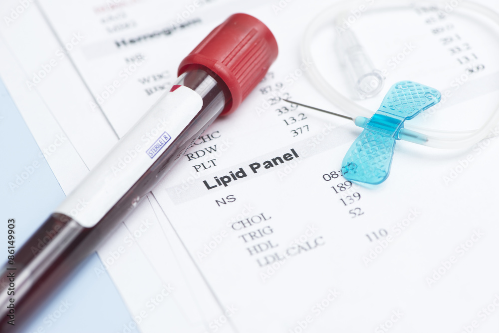 Lipid Panel Stock Photo | Adobe Stock