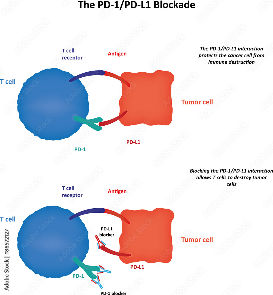 The PD1/PDL1 Blockade Illustration Stock | Adobe Stock